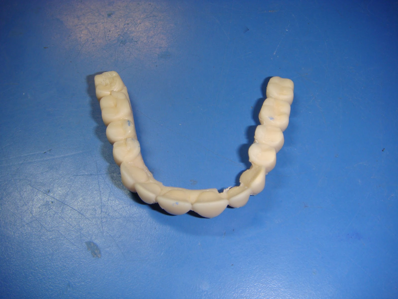 Understanding Prosthodontics - Tagore Dental College & Hospital-By ...