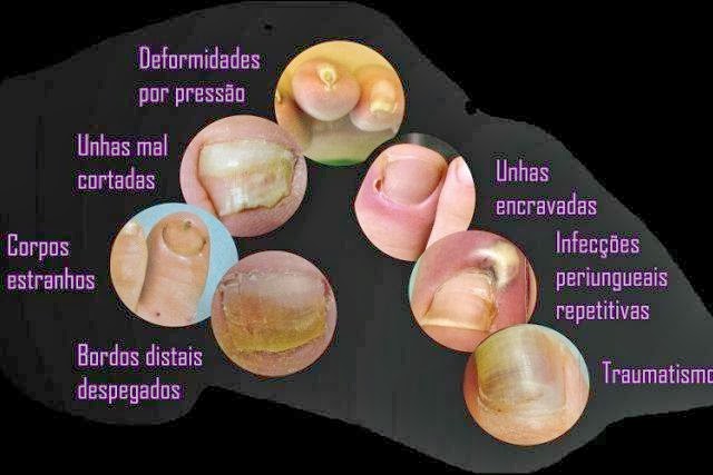 Liberte Sua Mente: ATENÇÃO....APRENDA A IDENTIFICAR AS ALTERAÇÕES ...