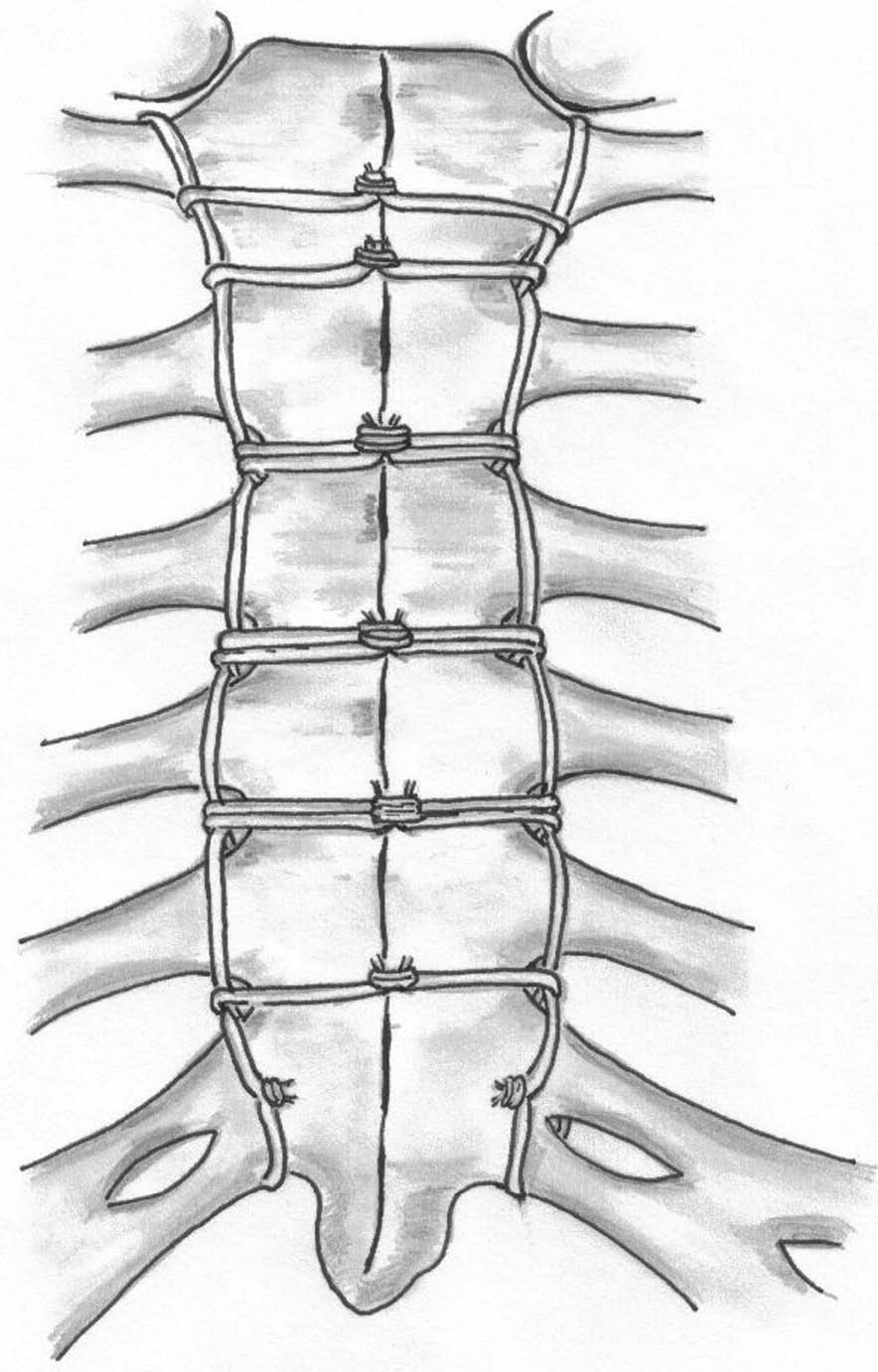 Doktor Mustafa Yuksel: Robicsek Teknikleri ve İsim Babası