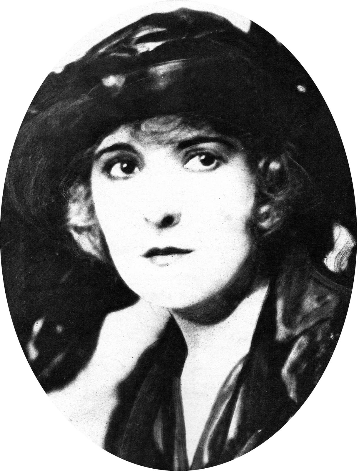 Gillette On Hillsborough: Anna Case Wannabes, 1922