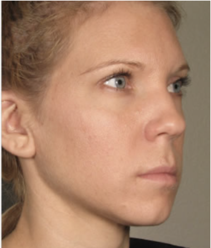 5 Reasons Your Friends Look Younger than You - The Skin Radar