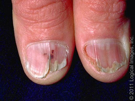 EL RINCÓN DE LA MEDICINA INTERNA: 02/01/2013 - 03/01/2013