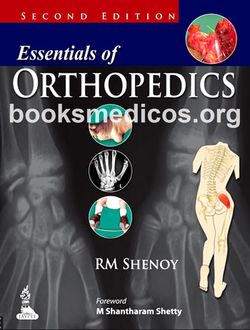 Essentials of Orthopedics 2nd Edition | booksmedicos