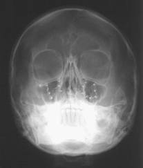 RADIOLOGIA: POSICIONAMENTO DA FACE