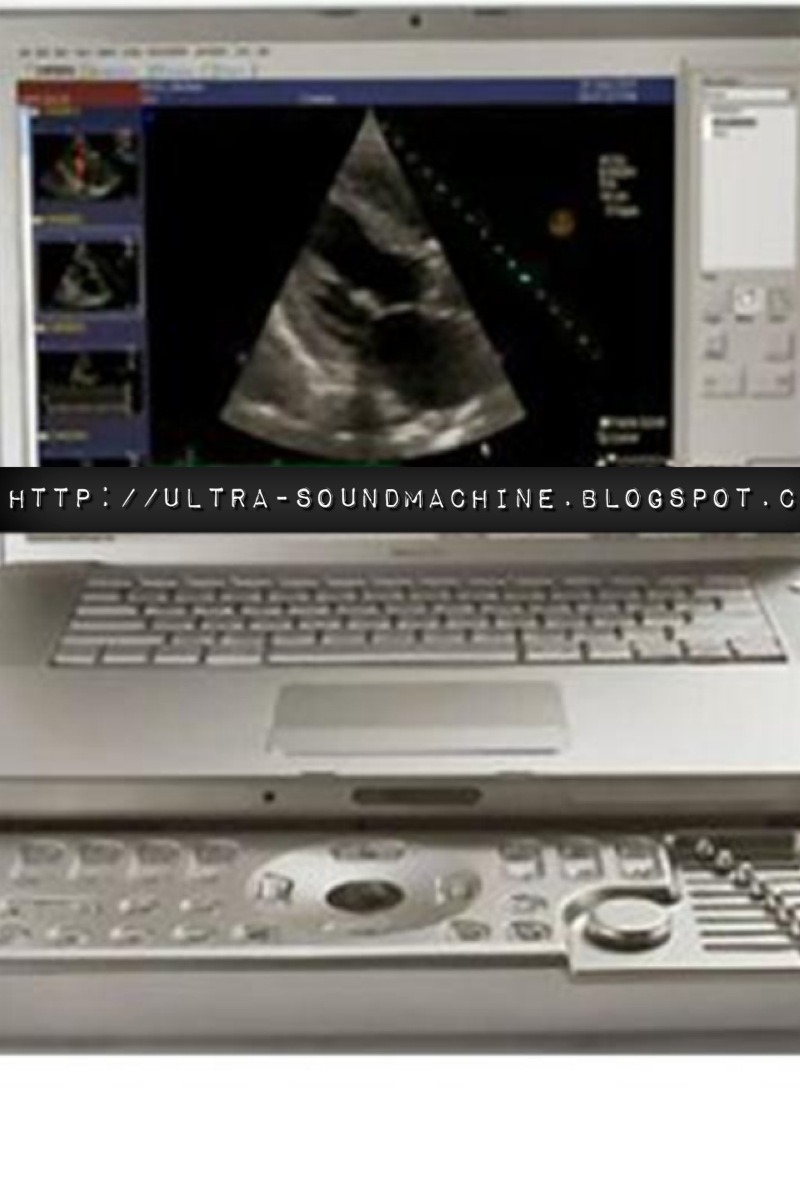 Ultra Sound Machine: Acuson P50 Portable Ultra-sound Machine