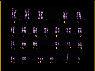 Grupo 6 Biología y Geología María y Zakia : Análisis de Cromosomas