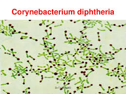 All About Difteri : April 2017