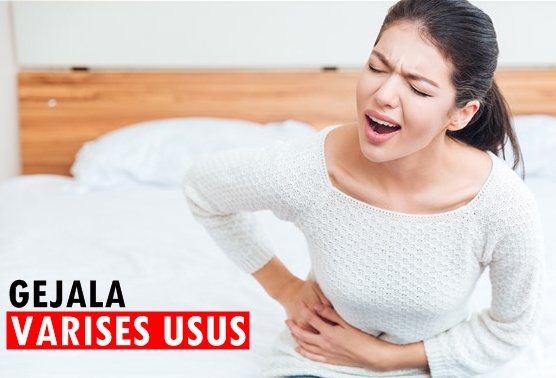 Gejala Varises Usus Yang Harus Anda Kenali Dari Sekarang - PUSAT ...
