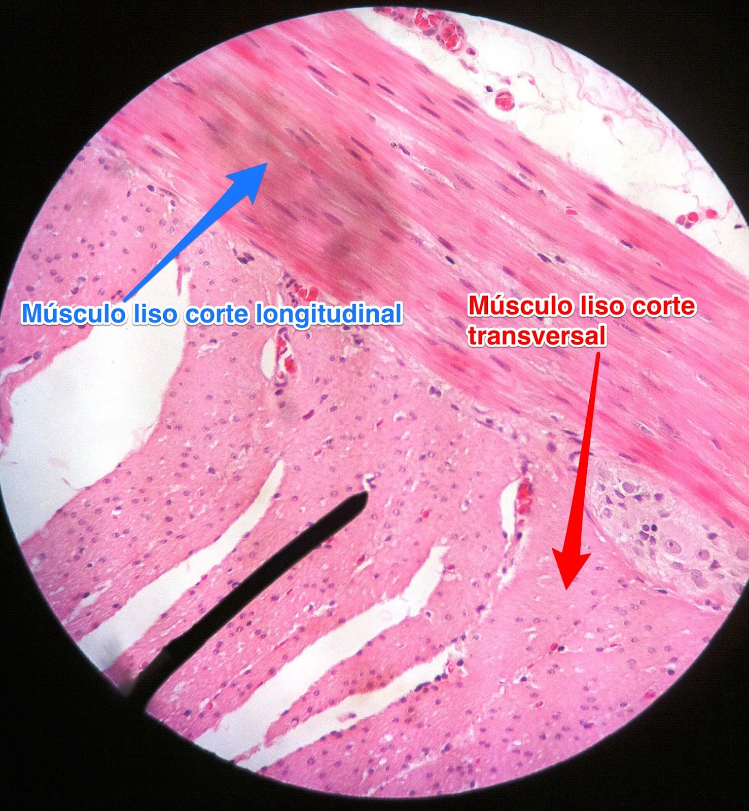 Bitácora de Histología. : Laboratorio 5: Tejido muscular.