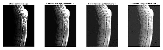 MATLAB Works: Basic Intensity Transformation Functions
