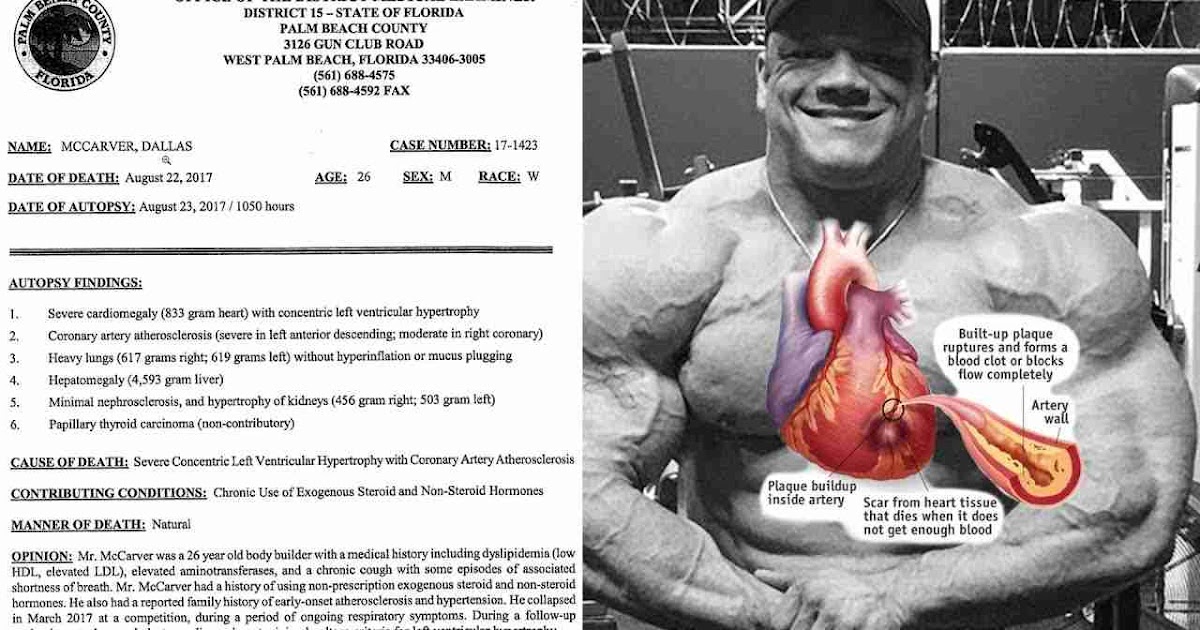 Autopsia revelada de Dallas McCarver | DIARIO DE UN FISICOCULTURISTA