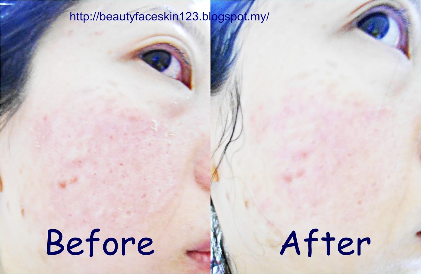 GREAT SKINandLIFE: REVIEW ON MY SCHEMING HERBAL ANTI ACNE MASK