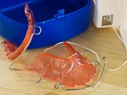 Kids Dental Care Tips: Why Utilizing Your Retainer Is Critical!
