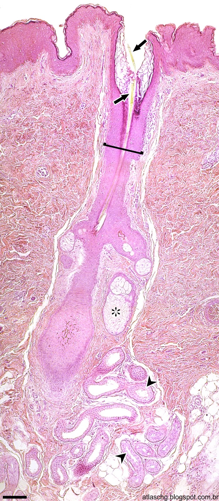 Histología Del Folículo Piloso