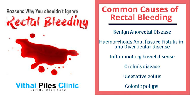 Rectal Bleeding – Causes & Treatment | vithaipileshospital
