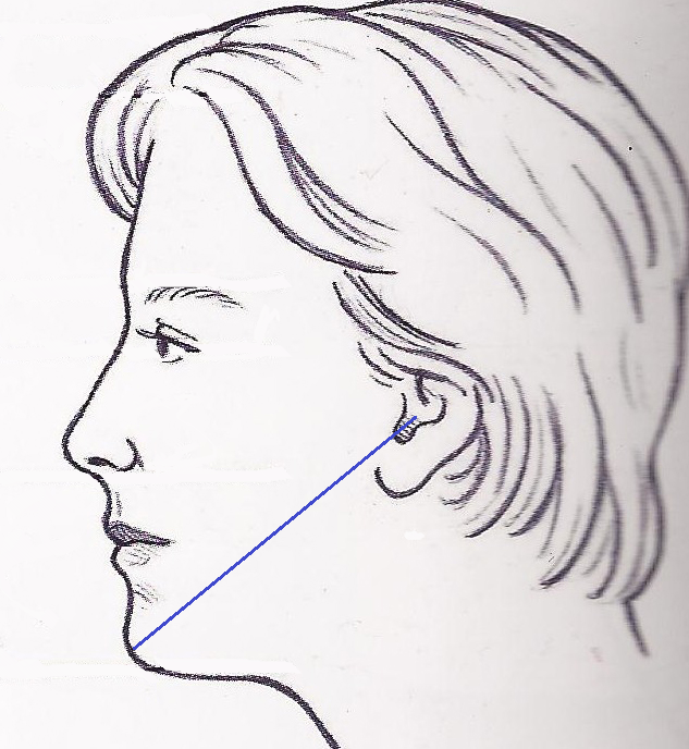 Estudo Radiográfico : PLANOS, MARCOS TOPOGRÁFICOS E LINHAS DO CRÂNIO