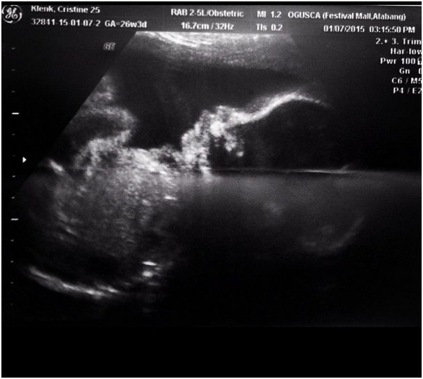 Popular Manila: Cristine Reyes Pregnant: Uploads Baby Ultrasound on ...