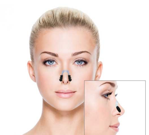 Perfect Nose Nose Straightener Review