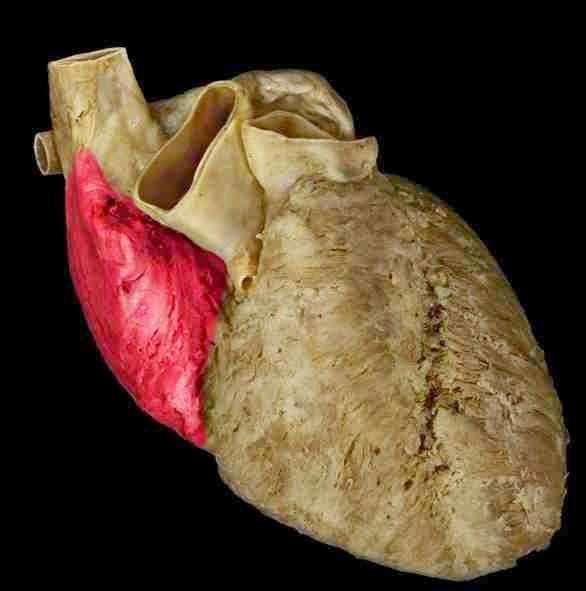 Manuali di Medicina Intensiva: Fisiologia dell'atrio destro (Capitolo 2 ...