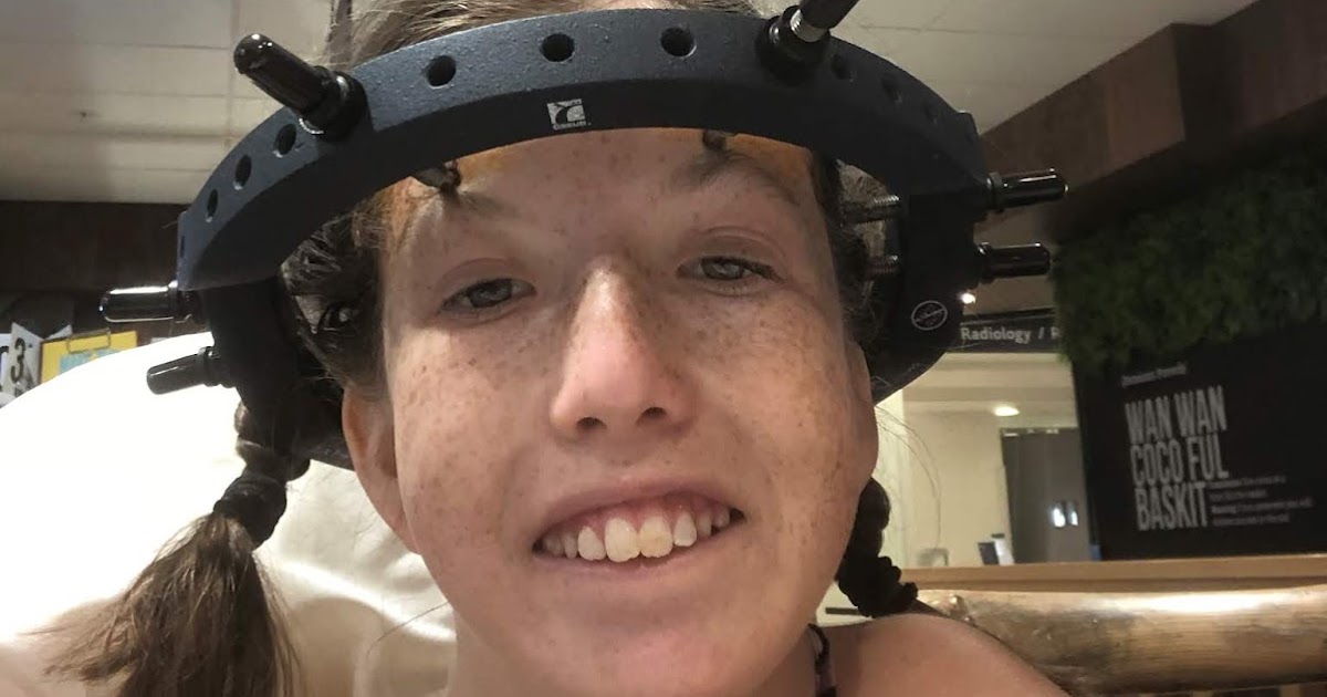 Ashling Louise Collins Updates: Halo Surgery done- PHEW! First Hurdle ...