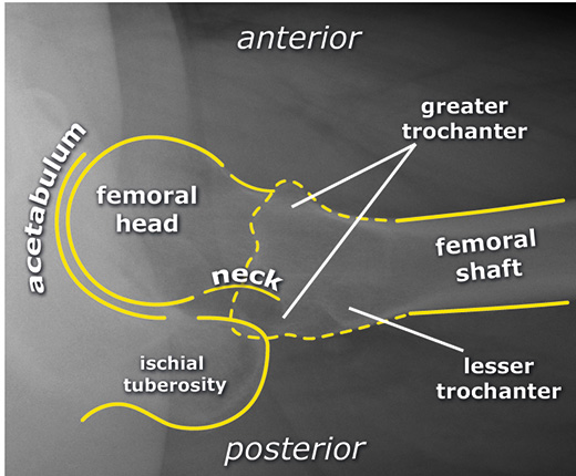 CamRadTech: Hip X ray