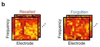 The Neurocritic: Automatically-Triggered Brain Stimulation during ...