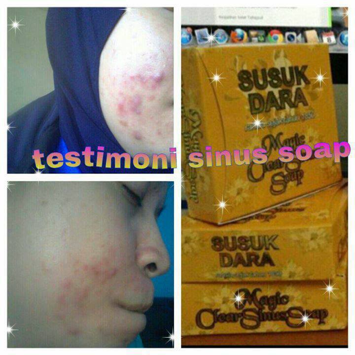 JAMU SUSUK DARA: RANGKAIAN PRODUK JAMU SUSUK DARA