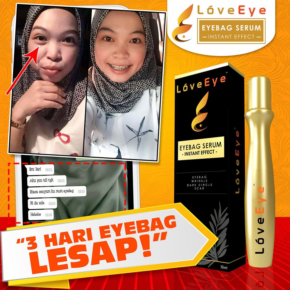 Cik Bebeq Beauty Shop : SERUM PENGHAPUS EYEBAG by LOVE EYE ( DELIVERY ...