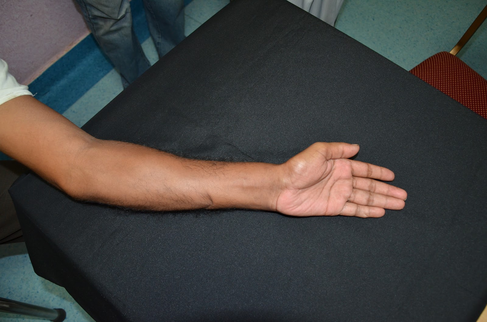 Open Fracture Both Bone Forearm Gross Contamination Outcome