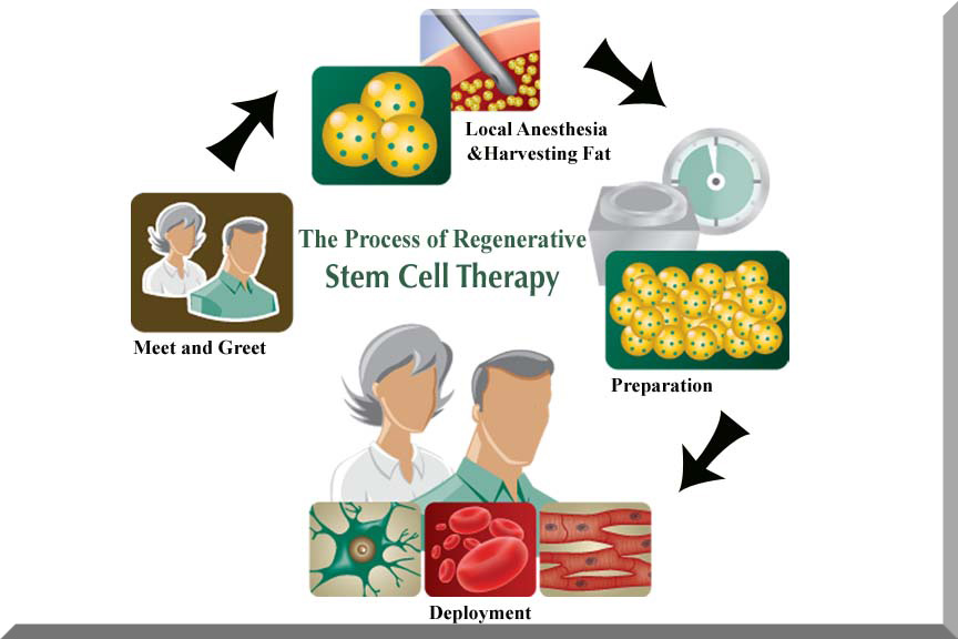 MARISSA STEM CELL THERAPY: 2015