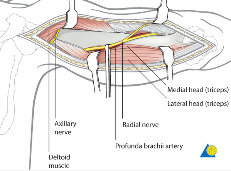 Shoulder and Elbow Surgery: Distal spiral metaphyseal humerus fractures ...