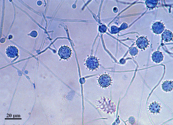 Microbiología y Epidemiología: Trichophyton rubrum. Trichophyton ...