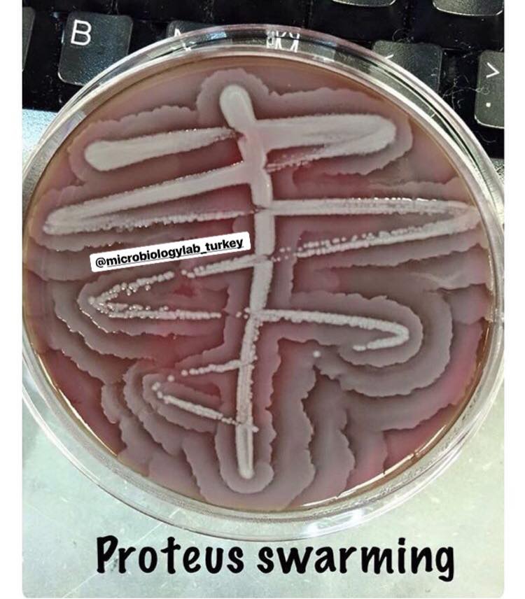 Proteus Spp 2