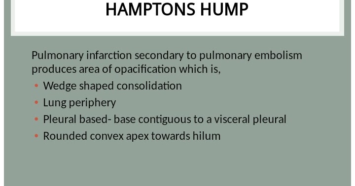 Chest Medicine Made Easy-Dr Deepu: Hamptons Hump