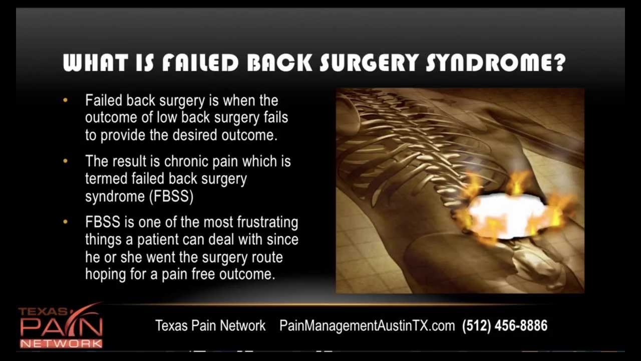 Failed back syndrome