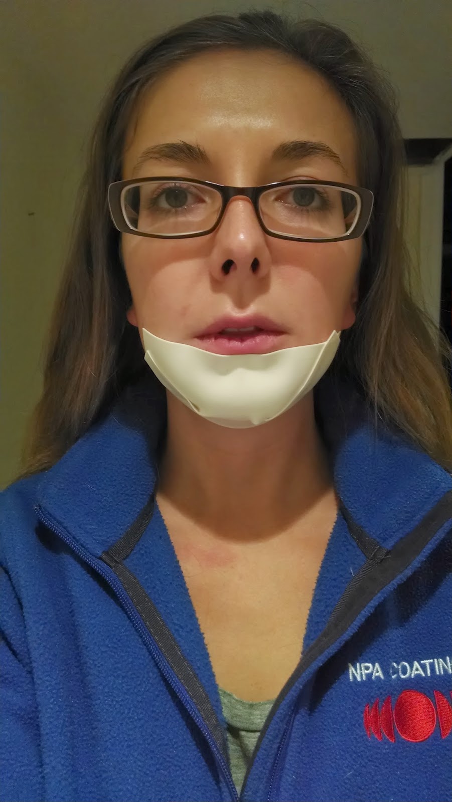 Everything Erin: Post-op Appt and then some... PHOTOS!