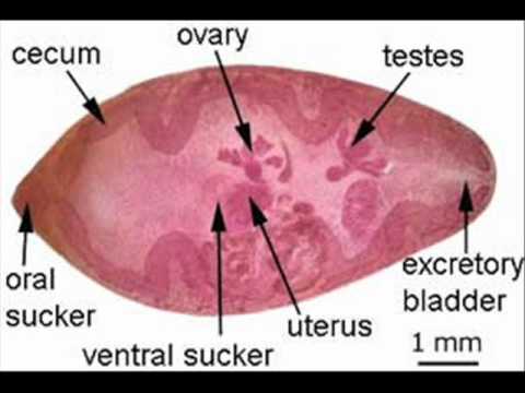 Lecture Notes in Medical Technology: Lecture #7b: THE LUNG FLUKES