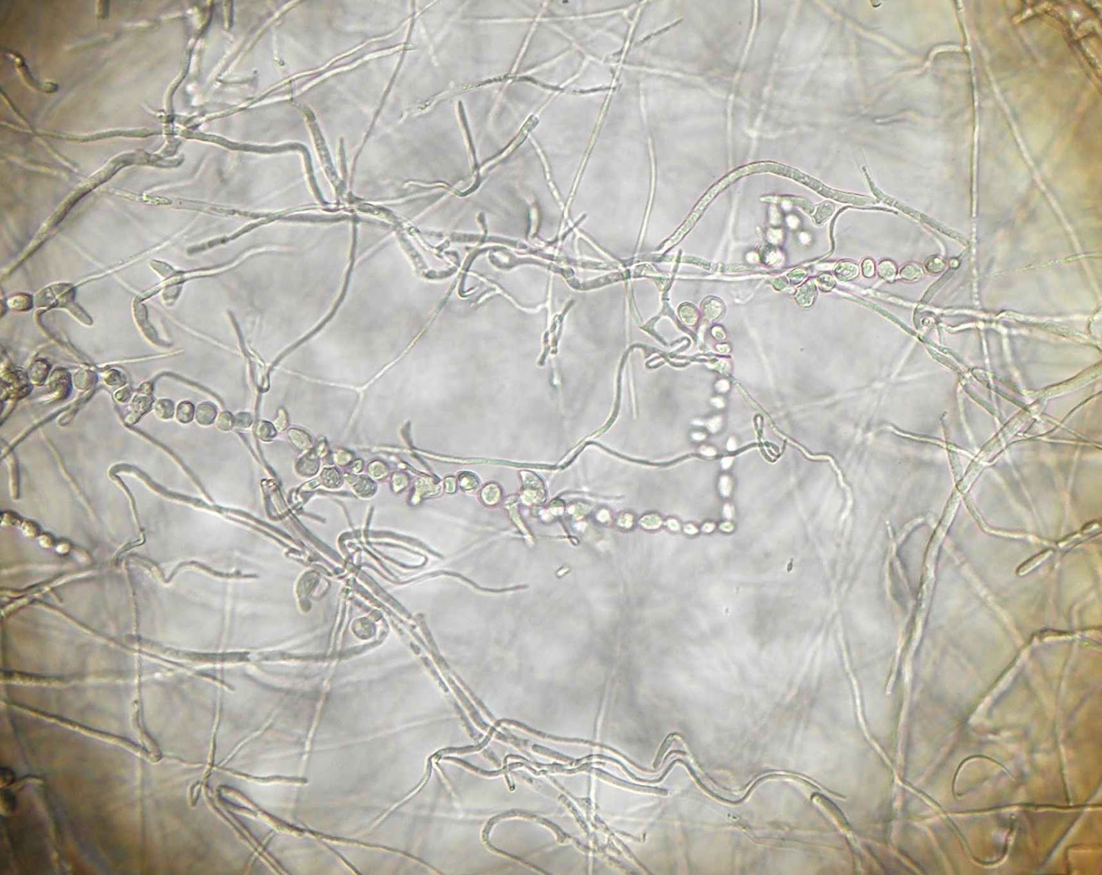 ATLAS MICOLOGIA: SCYTALIDIUM DIMIDIATUM (Neoscytalidium dimidiatum)
