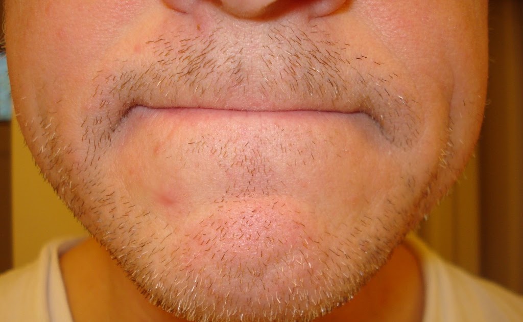 Just JoeP: The Scraggly Beard Must Go