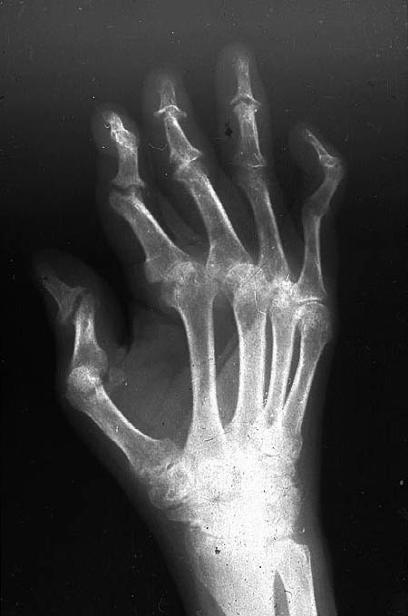 Soy Criminalista : DACTILOSCOPIA