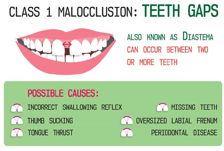 Dentist Best Dental Clinic in Vasundhara: What do you mean by ...