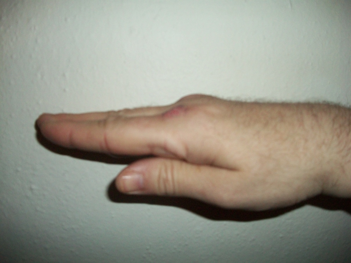 Ryukyu Martial Arts: Small Surface Strikes & Structural Support