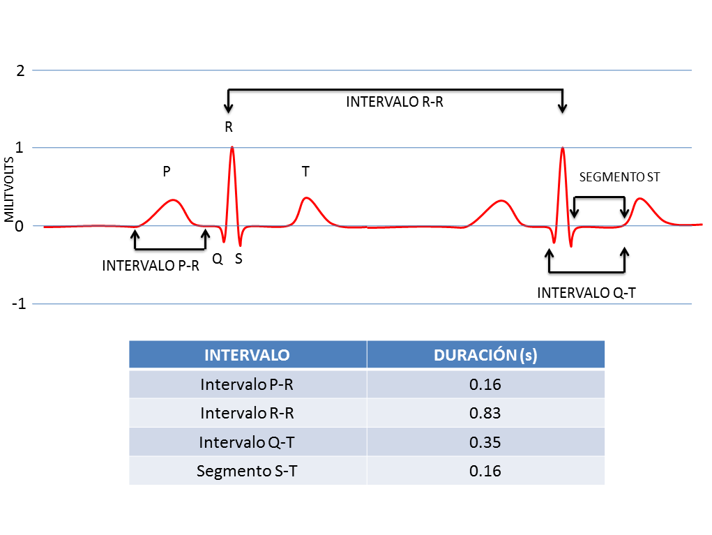Fisiología - Alan Meneses Juárez - Grupo IV-5: ECG Y SUS INTERVALOS