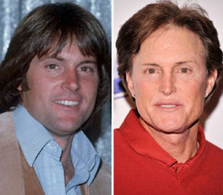 Actualidade Religiosa: Bruce Jenner, Casamento e Verdadeira Caridade