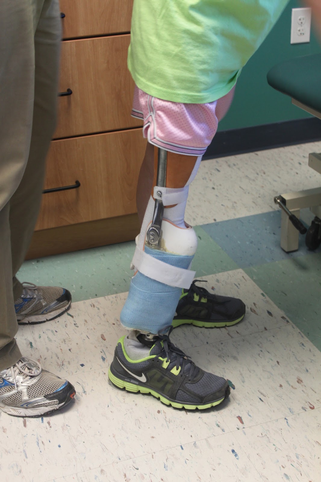 Leaving It All On The Field: Rotationplasty Prosthetic Leg...The Final ...