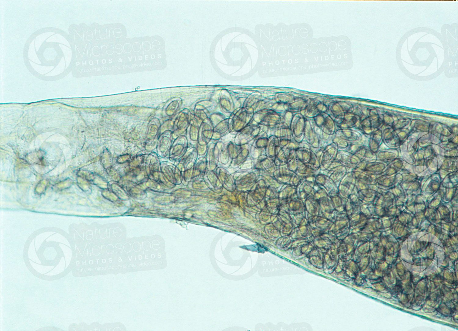 ENTEROBIUS VERMICULARES ( OXIUROS)