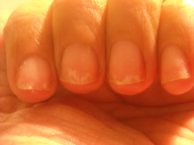 Beauty Blog by Lisa - TIPS from head to toe!: From weak, brittle to ...