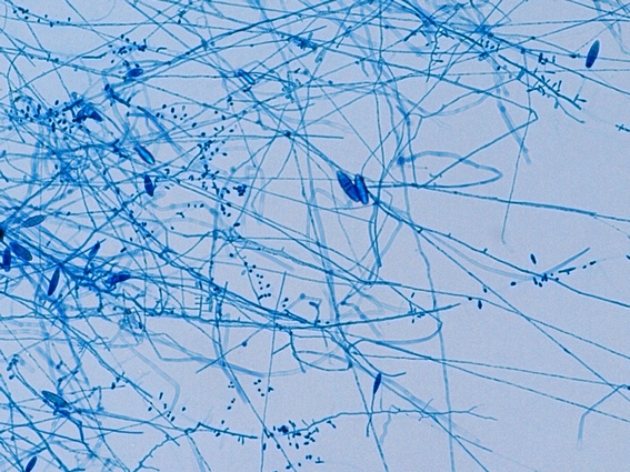 Fun With Microbiology (What's Buggin' You?): Microsporum gypseum