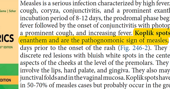 KnowMed: MCQ - Pathognomonic Sign of Measles