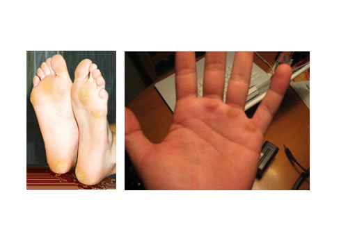 The Kendo Girl: Blisters and calluses